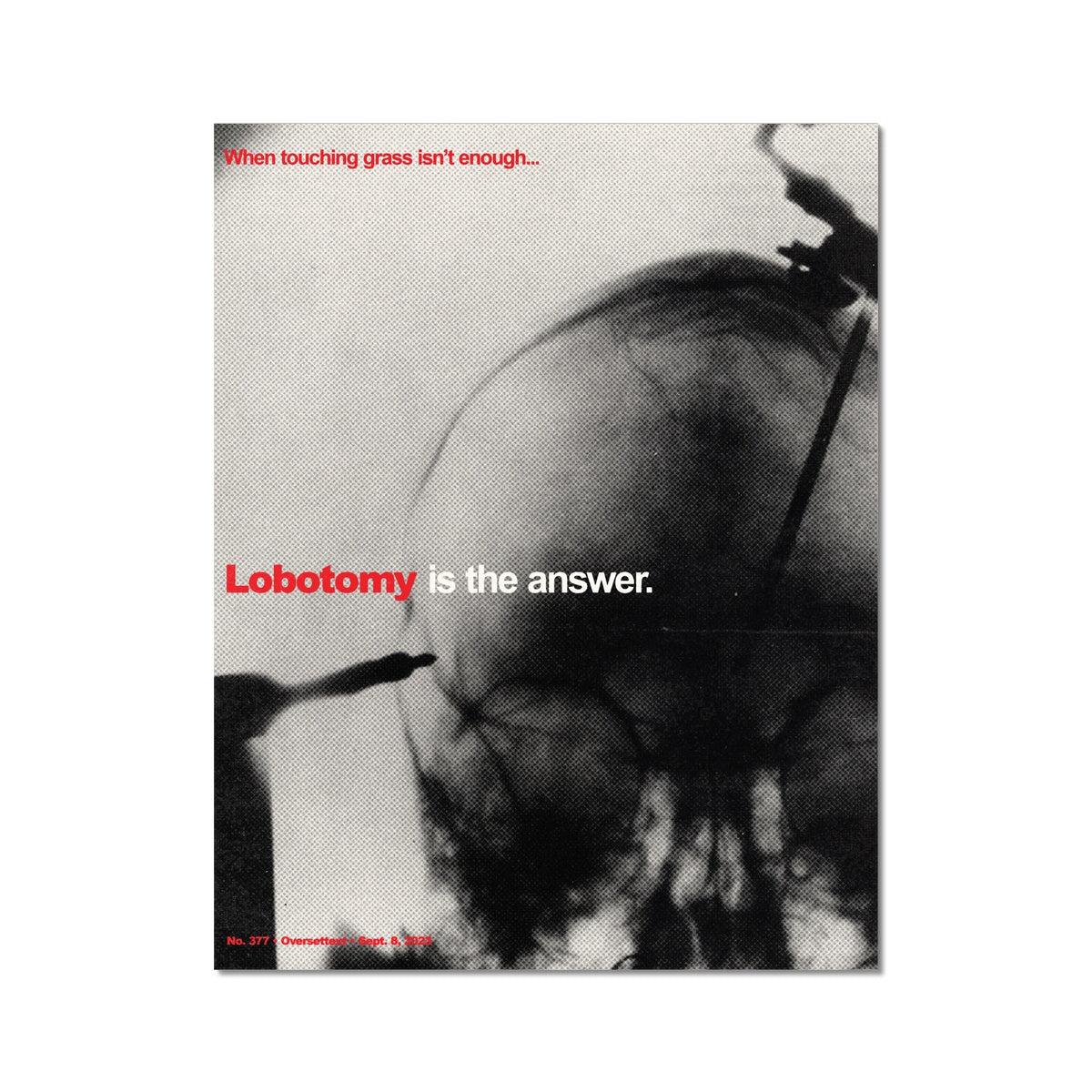 No. 377 Lobotomy Wall Art Poster – The Oversettext Store